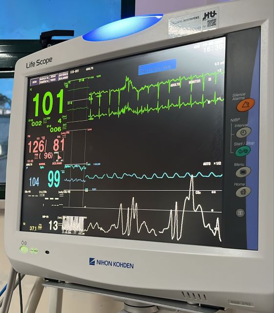 Hospital Universitário instala novos monitores e camas hospitalares na ...